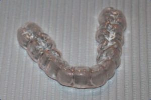 L’articulation temporo-mandibulaire (ATM) | Bücco