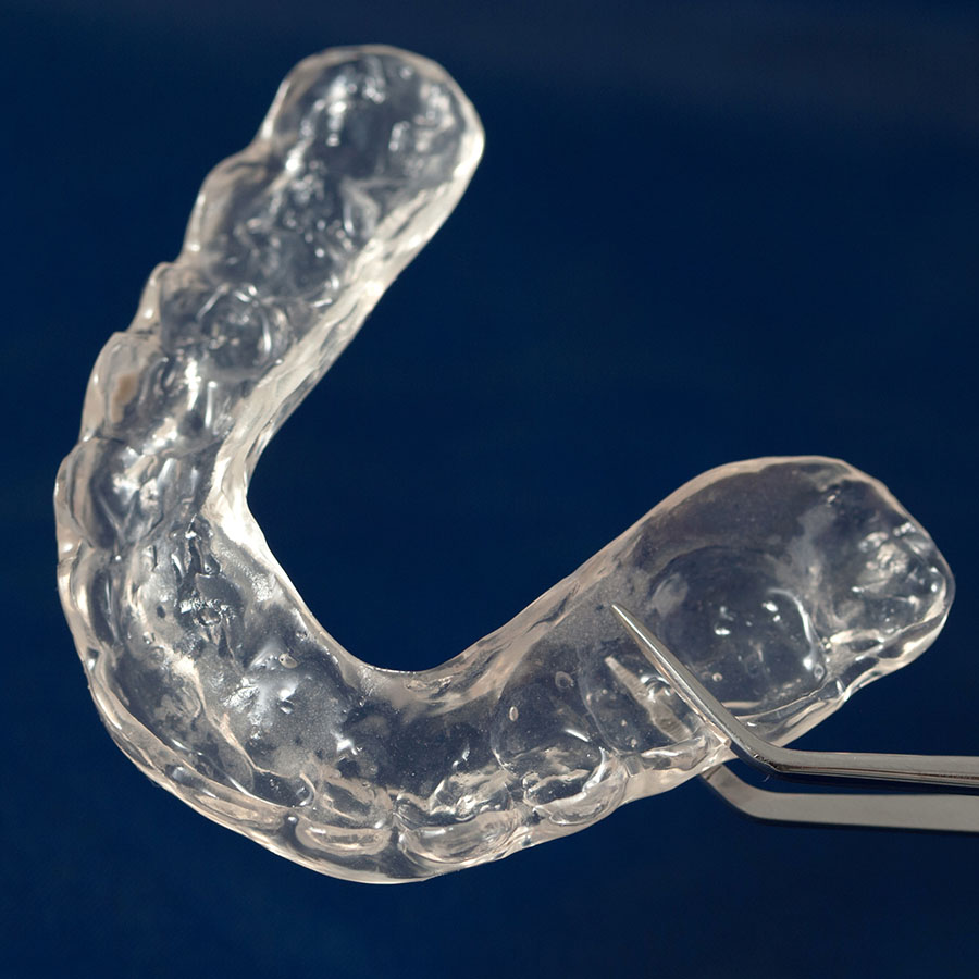 La plaque occlusale | Bücco - Guide des soins, Trouver le bon dentiste ...